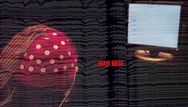 Brain Noise Being Labeled as Free Will? Not So Fast!